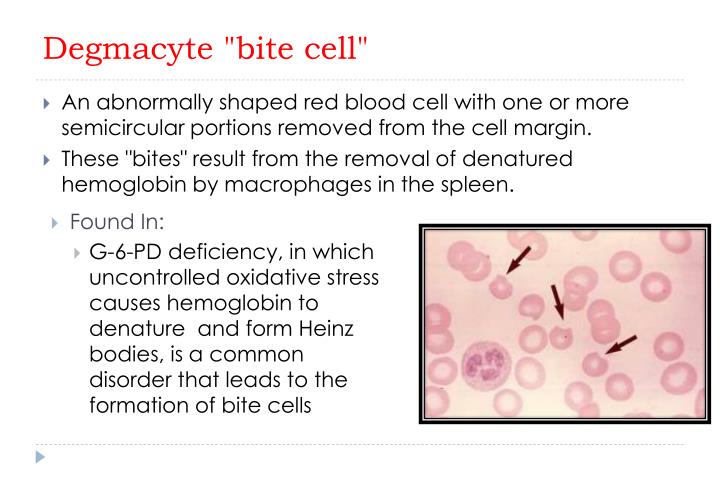 PPT - Practical of Clinical Hematology PowerPoint Presentation - ID:2238955