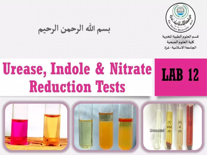 PPT - Urease Test PowerPoint Presentation, free download - ID:2240416