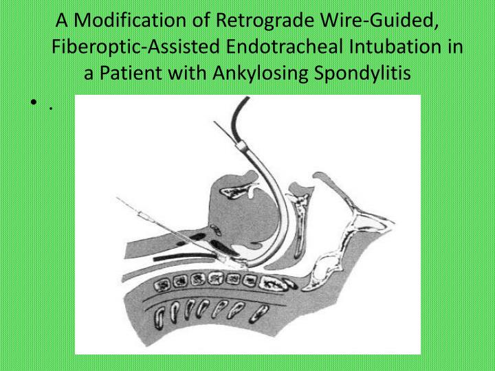PPT - Retrograde intubation PowerPoint Presentation - ID:2240425