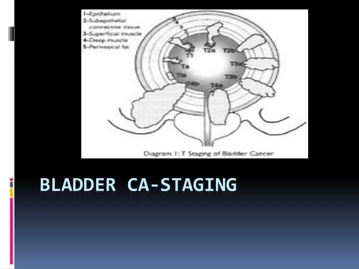 PPT - Bladder CA-Staging PowerPoint Presentation, free download - ID ...