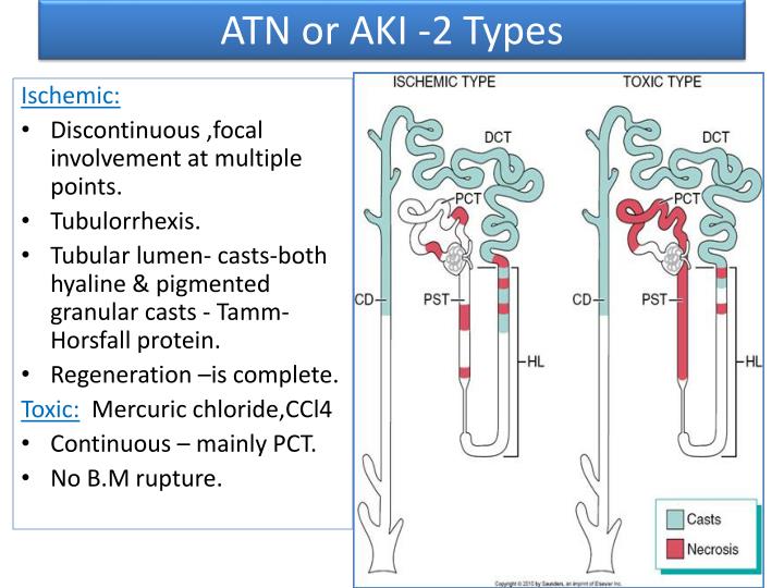 PPT - Kidney- Tubulo -interstitial disorders PowerPoint Presentation ...