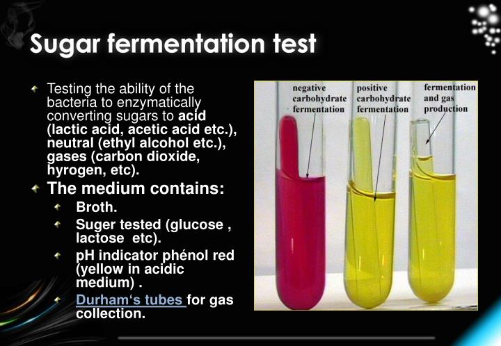 PPT - Bacteriological laboratory Diagnosis PowerPoint Presentation - ID ...