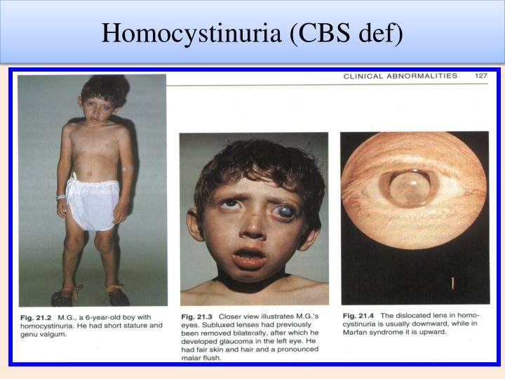 PPT - Inborn Errors of Metabolism(IEM) Lecture 2 PowerPoint ...