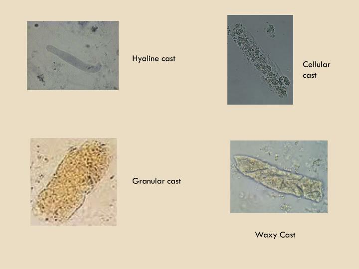 PPT - URINALYSIS PowerPoint Presentation - ID:2240987