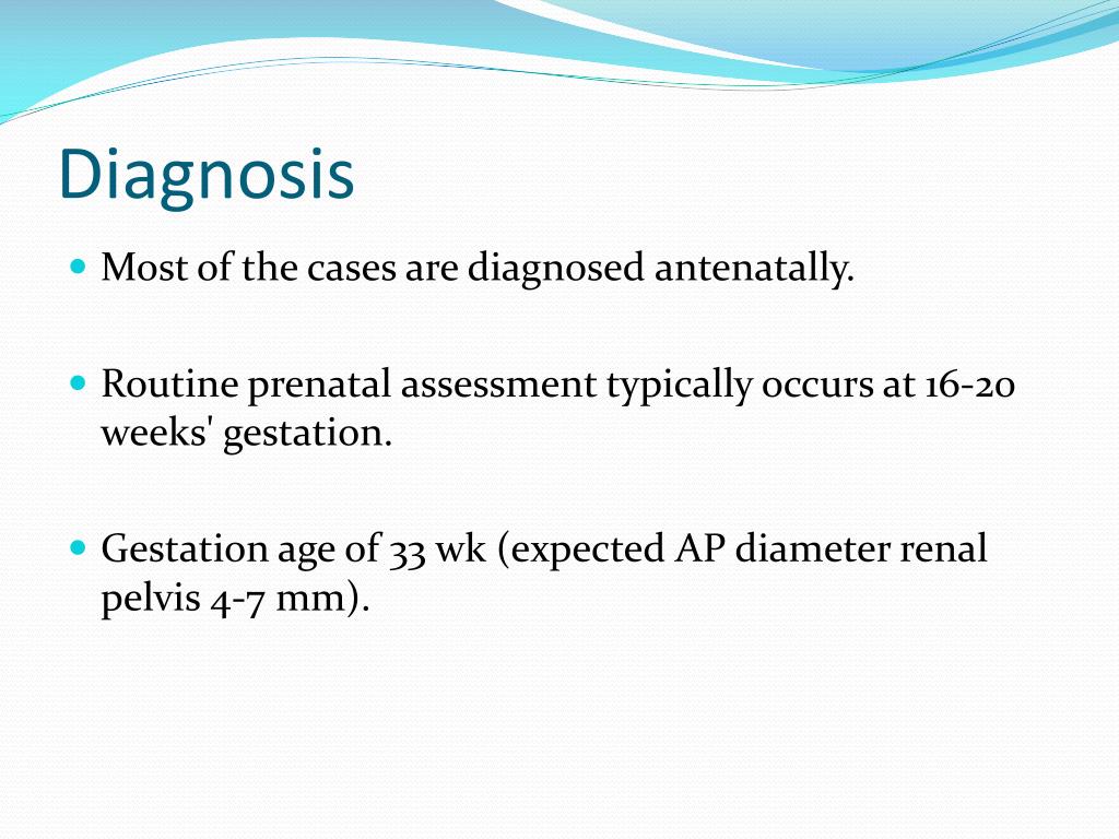 PPT - Management of PUJO Adult & Pediatric PowerPoint Presentation - ID ...