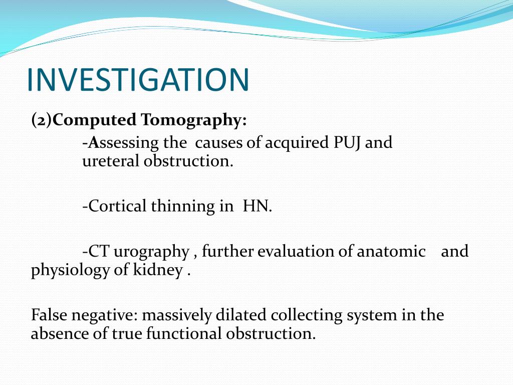 PPT - Management of PUJO Adult & Pediatric PowerPoint Presentation - ID ...