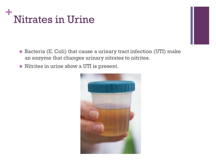 PPT - Urinalysis 101 PowerPoint Presentation - ID:2241078