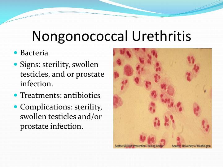PPT - STIs PowerPoint Presentation - ID:2241152