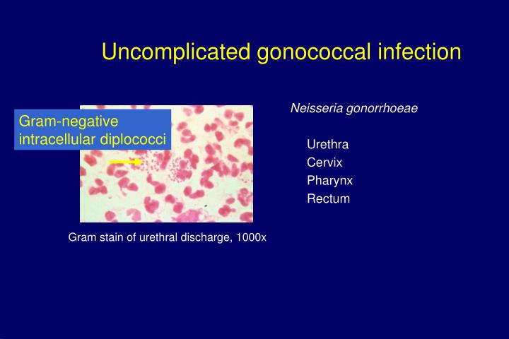 Systemic Gonococcal Infection Definition – WMQBF