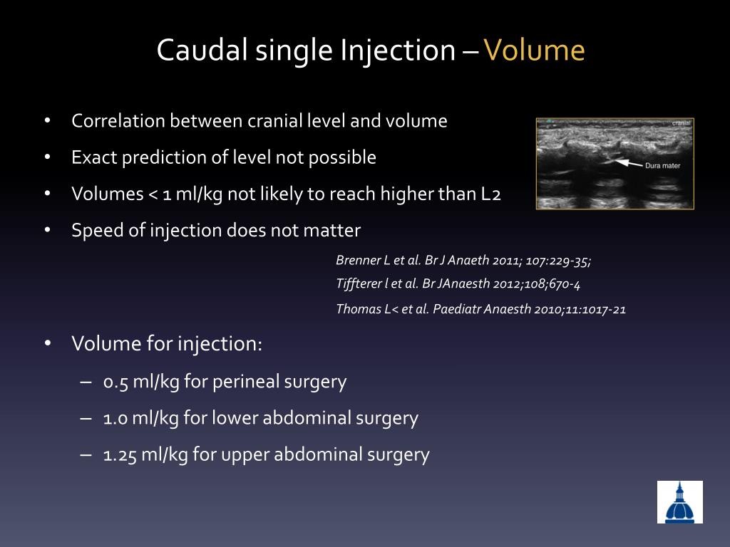 PPT - Kiddie-Caudals Caudal Epidural Analgesia in Everyday Pediatric ...