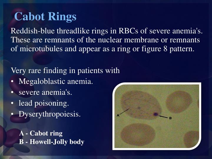 PPT - RBC’s Morphology PowerPoint Presentation - ID:2241450