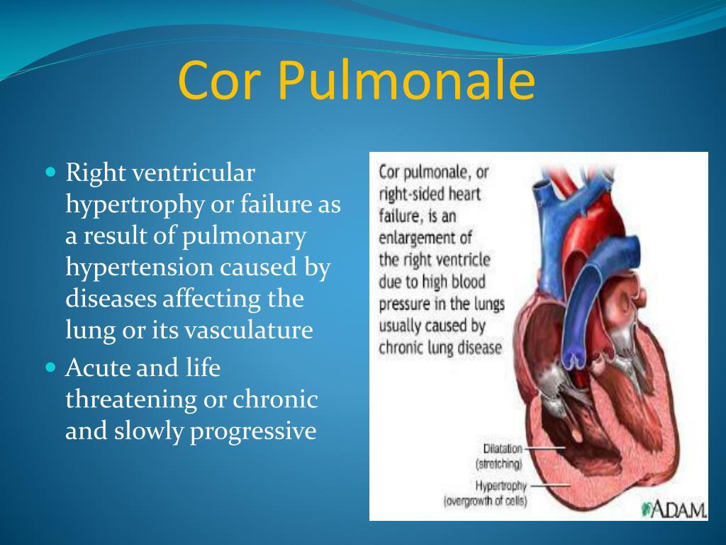 PPT Respiratory Failure Cor Pulmonale PowerPoint Presentation ID PPT Respiratory Failure Cor Pulmonale PowerPoint Presentation ID