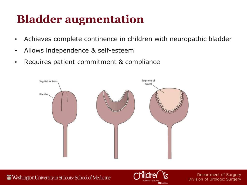 PPT - Evaluation, treatment & intervention in the pediatric neuropathic ...