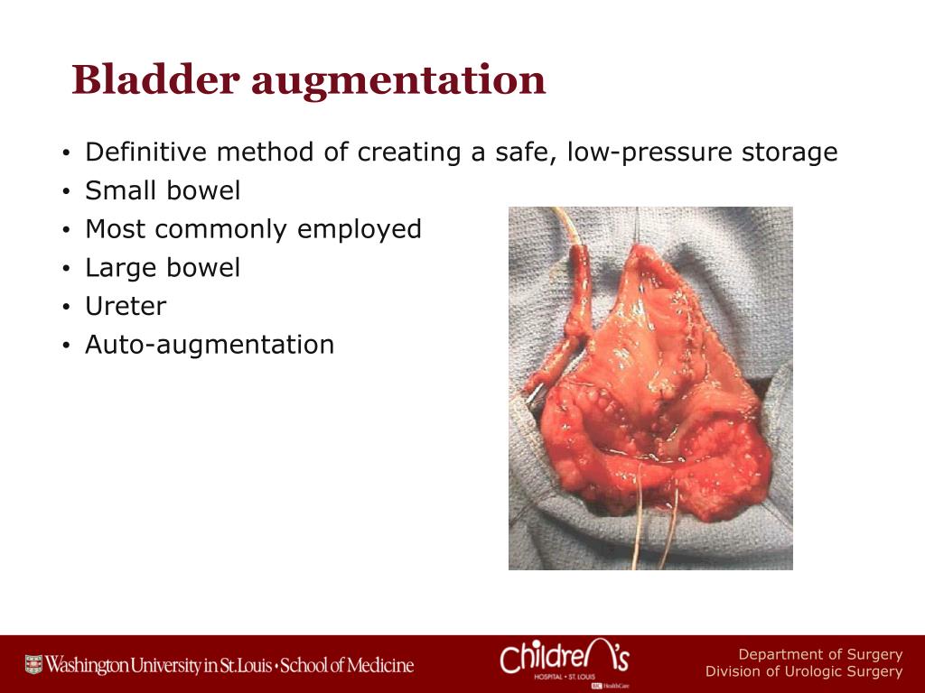 PPT - Evaluation, treatment & intervention in the pediatric neuropathic ...