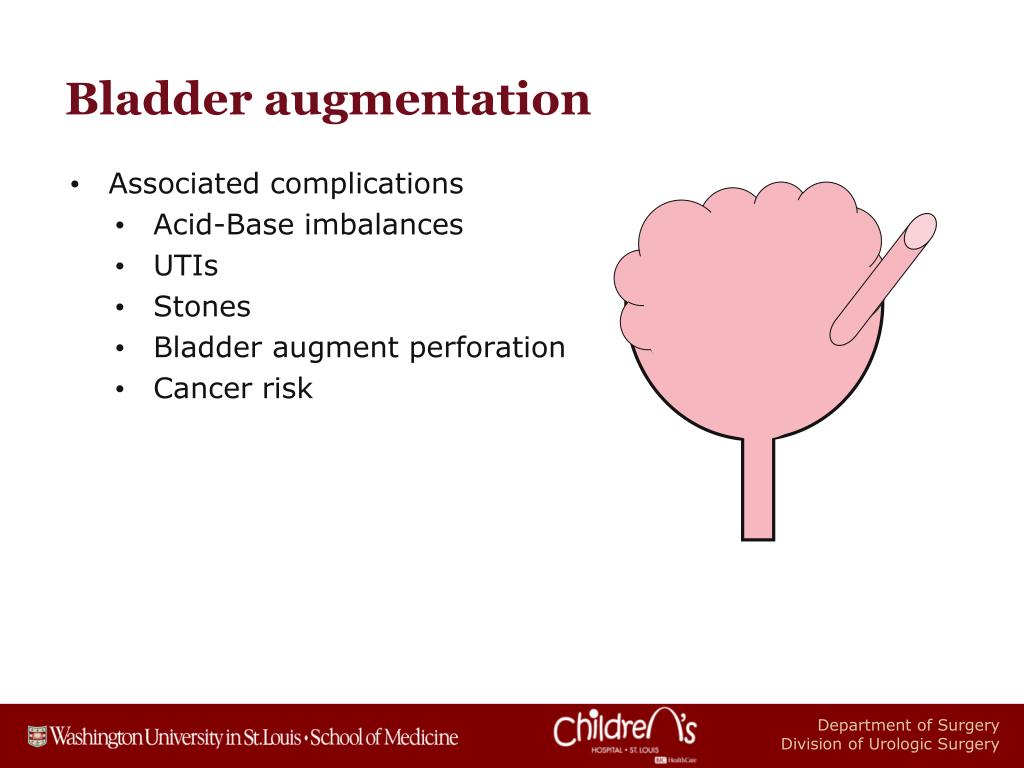 PPT - Evaluation, treatment & intervention in the pediatric neuropathic ...
