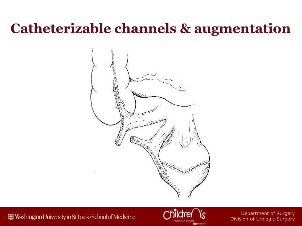 PPT - Evaluation, treatment & intervention in the pediatric neuropathic ...