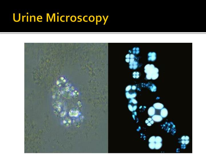 PPT - SIGNS & SYMPTOMS OF URINARY SYSTEM PowerPoint Presentation - ID ...