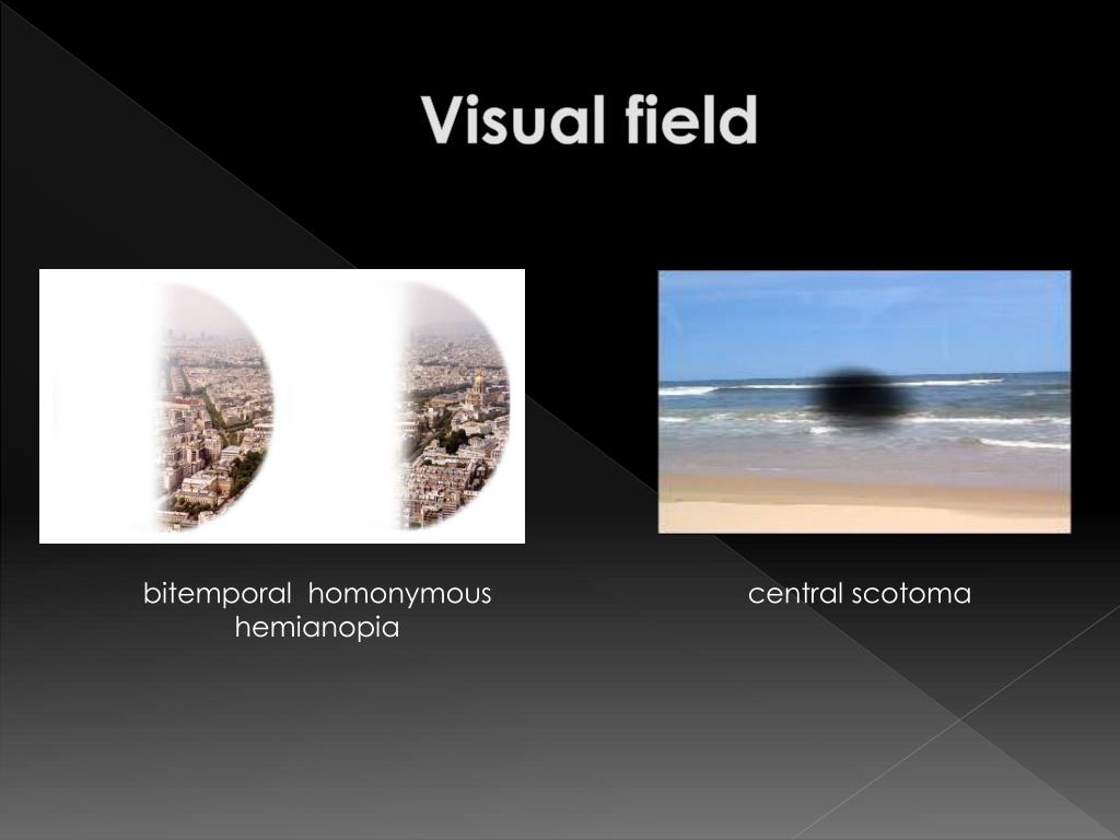 PPT - OPHTHALMOLOGICAL CHANGES DURING PREGNANCY BY: ABDULKRIM ...