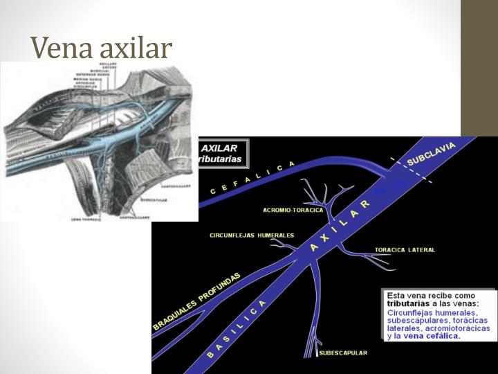 PPT - Axila y mama PowerPoint Presentation - ID:2243588