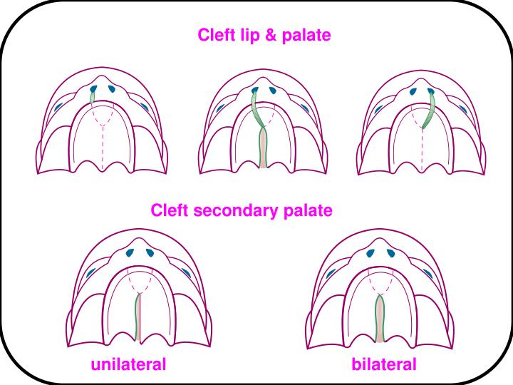 PPT - Development of the face and palate. PowerPoint Presentation - ID ...
