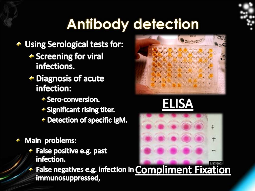 PPT - Diagnosis of Viral infections PowerPoint Presentation, free ...