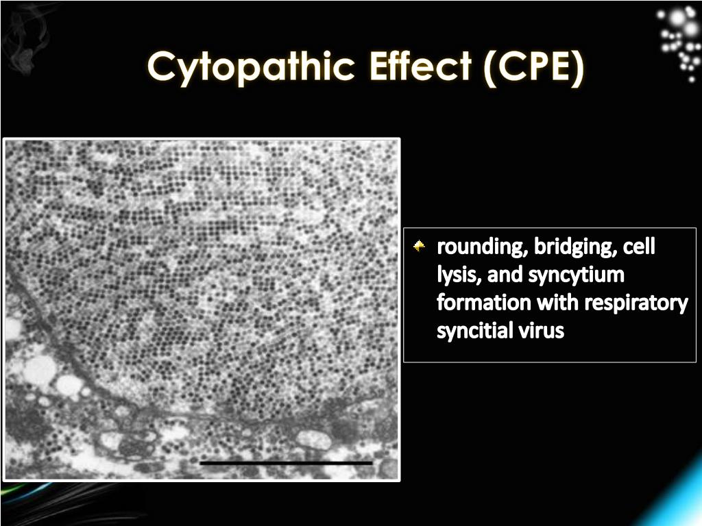 PPT - Diagnosis of Viral infections PowerPoint Presentation, free ...