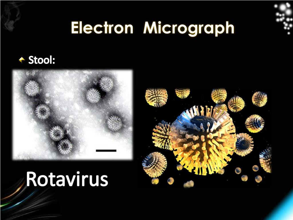 PPT - Diagnosis of Viral infections PowerPoint Presentation, free ...