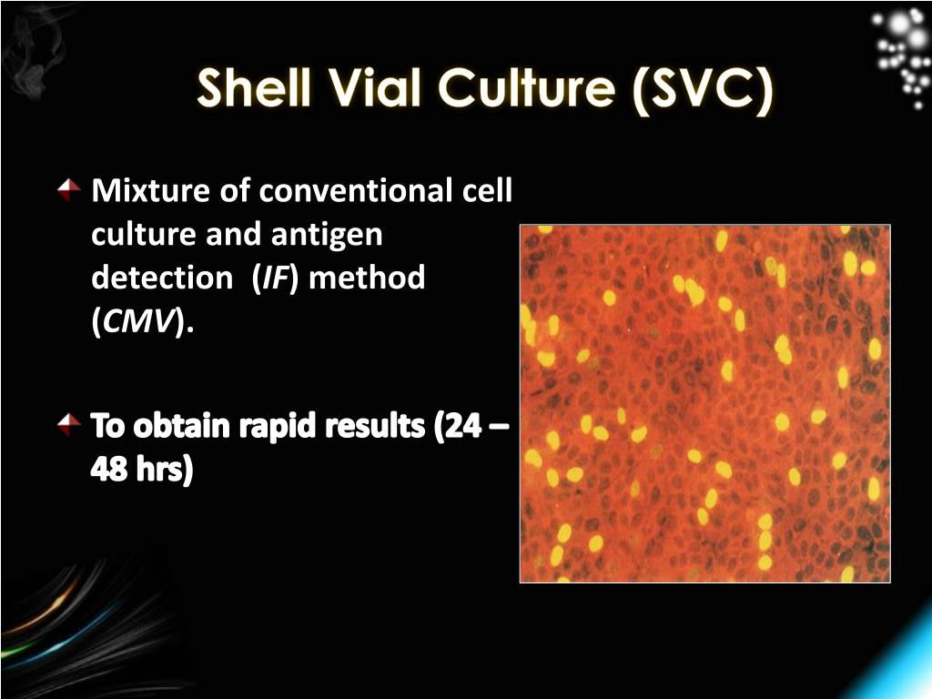 PPT - Diagnosis of Viral infections PowerPoint Presentation, free ...