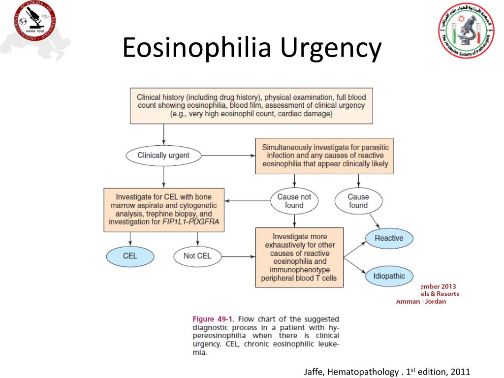 PPT - A challenging case of eosinophilia, the era of personalized ...