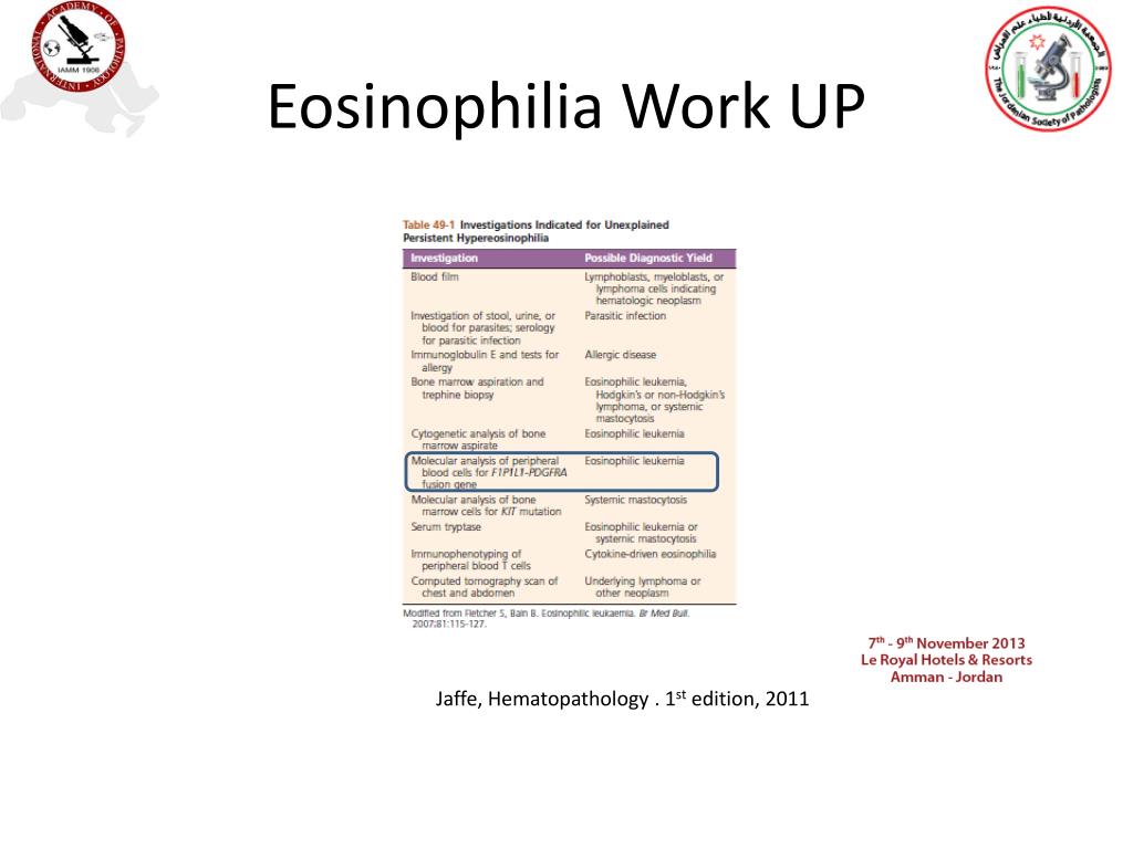 PPT - A challenging case of eosinophilia, the era of personalized ...