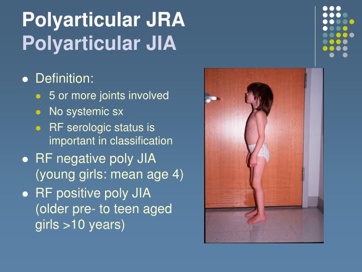 PPT - Board Review: Pediatric Rheumatology PowerPoint Presentation - ID ...