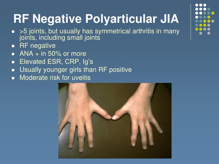 PPT - Board Review: Pediatric Rheumatology PowerPoint Presentation - ID ...