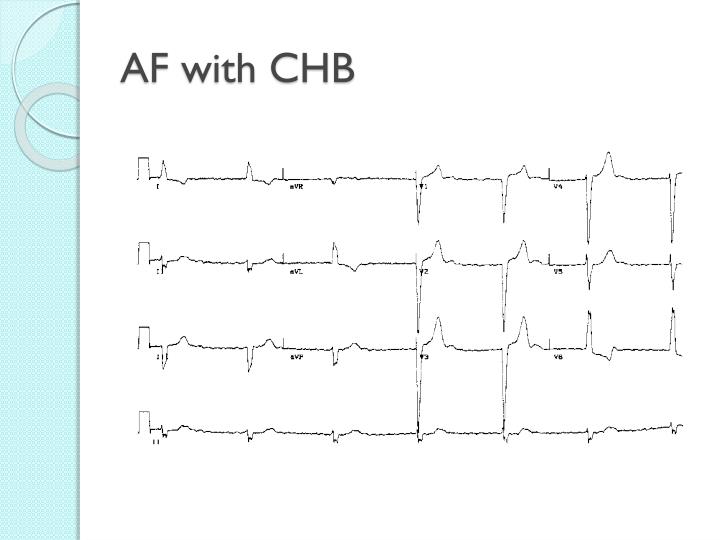 PPT - Heterogeneity Of AF Not all AF are the same!!!!!! PowerPoint ...