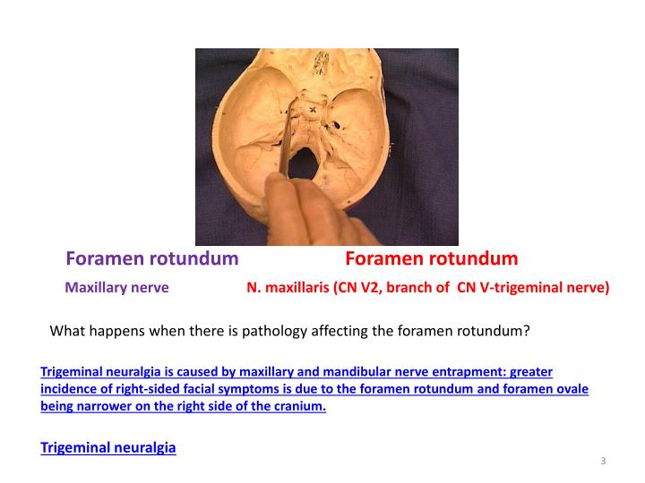 PPT - Optic canal Canalis opticus PowerPoint Presentation - ID:2244703