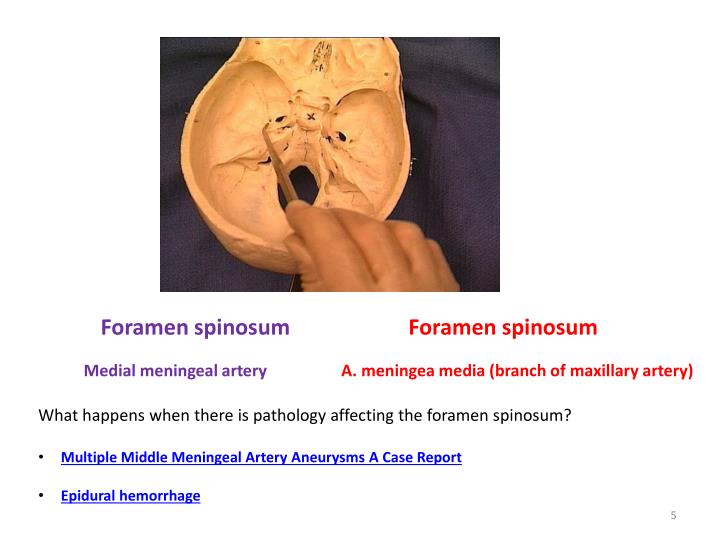 PPT - Optic canal Canalis opticus PowerPoint Presentation - ID:2244703
