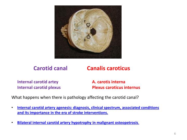 PPT - Optic canal Canalis opticus PowerPoint Presentation - ID:2244703