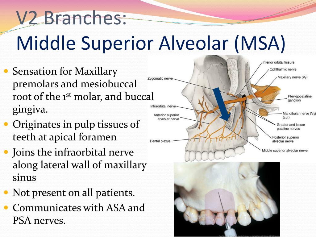 PPT - LOCAL ANESTHESIA FOR THE DENTAL HYGIENIST: PowerPoint ...