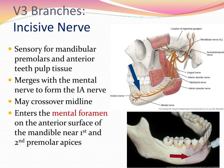 PPT - LOCAL ANESTHESIA FOR THE DENTAL HYGIENIST: PowerPoint ...