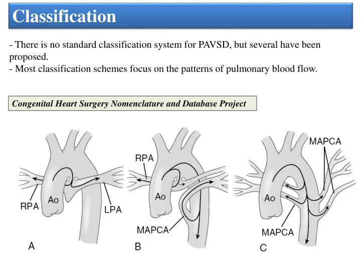 PPT - Anatomy and pathophysiology of tetralogy of Fallot PowerPoint ...