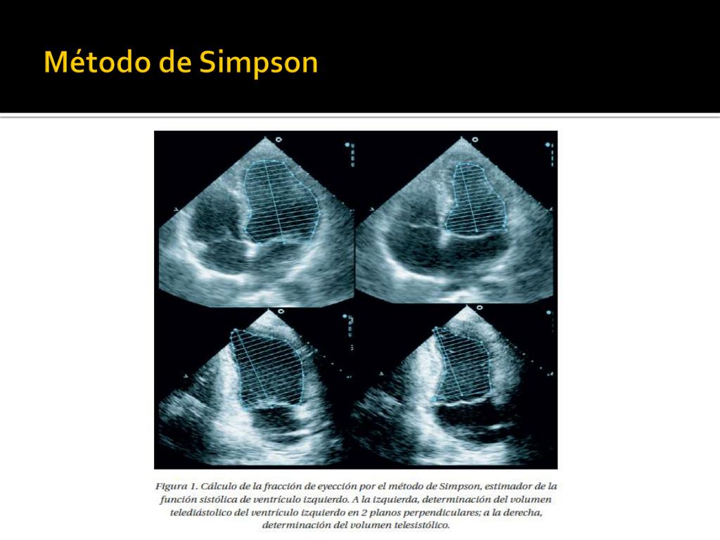 PPT - ECOCARDIOGRAMA2D Agosto 2013 PowerPoint Presentation, free ...