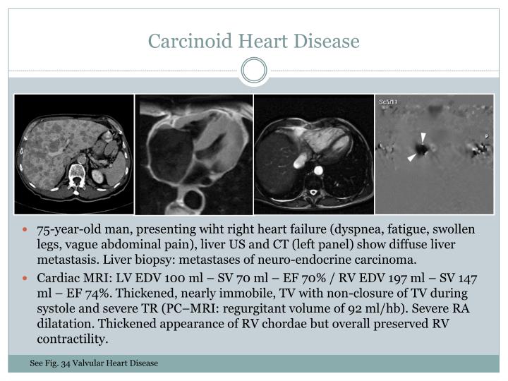 PPT - Teaching Cases PowerPoint Presentation - ID:2249147