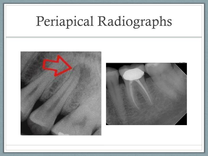 PPT - Types of Radiographic Surveys PowerPoint Presentation - ID:2249724