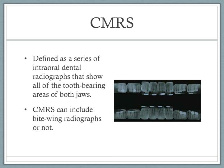 PPT - Types of Radiographic Surveys PowerPoint Presentation - ID:2249724