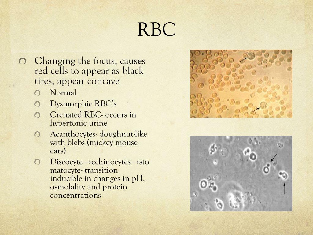 PPT - APPROACH TO A PATIENT WITH SUSPECTED KIDNEY DISEASE PowerPoint ...