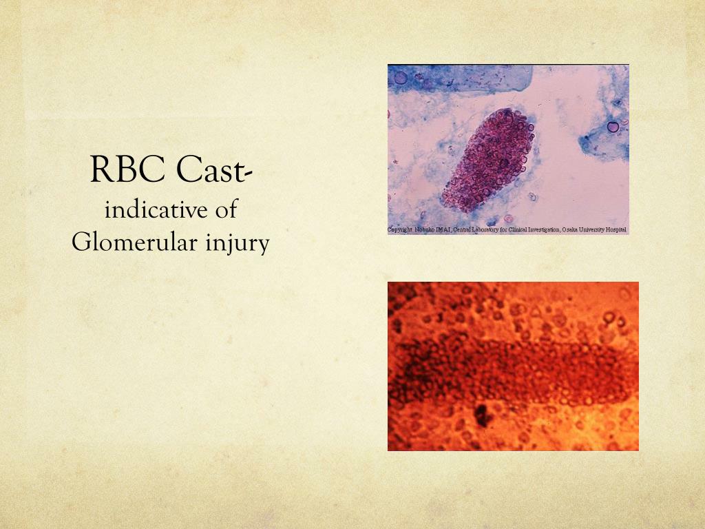 PPT - APPROACH TO A PATIENT WITH SUSPECTED KIDNEY DISEASE PowerPoint ...