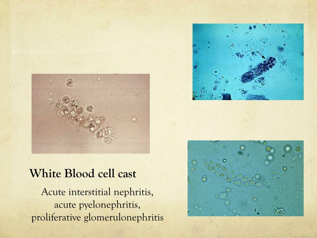 PPT - APPROACH TO A PATIENT WITH SUSPECTED KIDNEY DISEASE PowerPoint ...