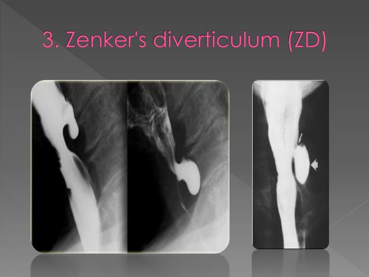PPT - Barium Swallow PowerPoint Presentation - ID:2250793