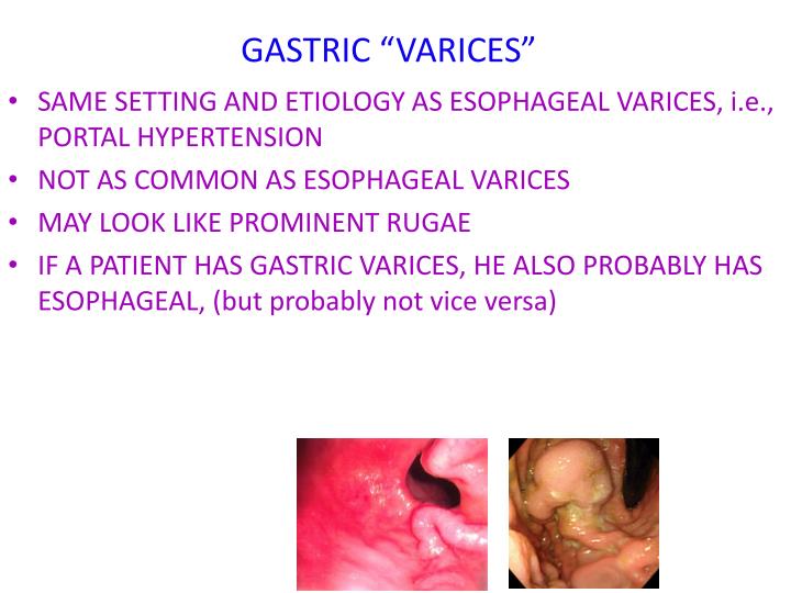 PPT - Lecture 8.3 rad240 pathology PowerPoint Presentation - ID:2250916