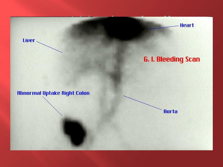PPT - CATASTROPHIC ABDOMINAL EMERGENCIES PowerPoint Presentation - ID ...