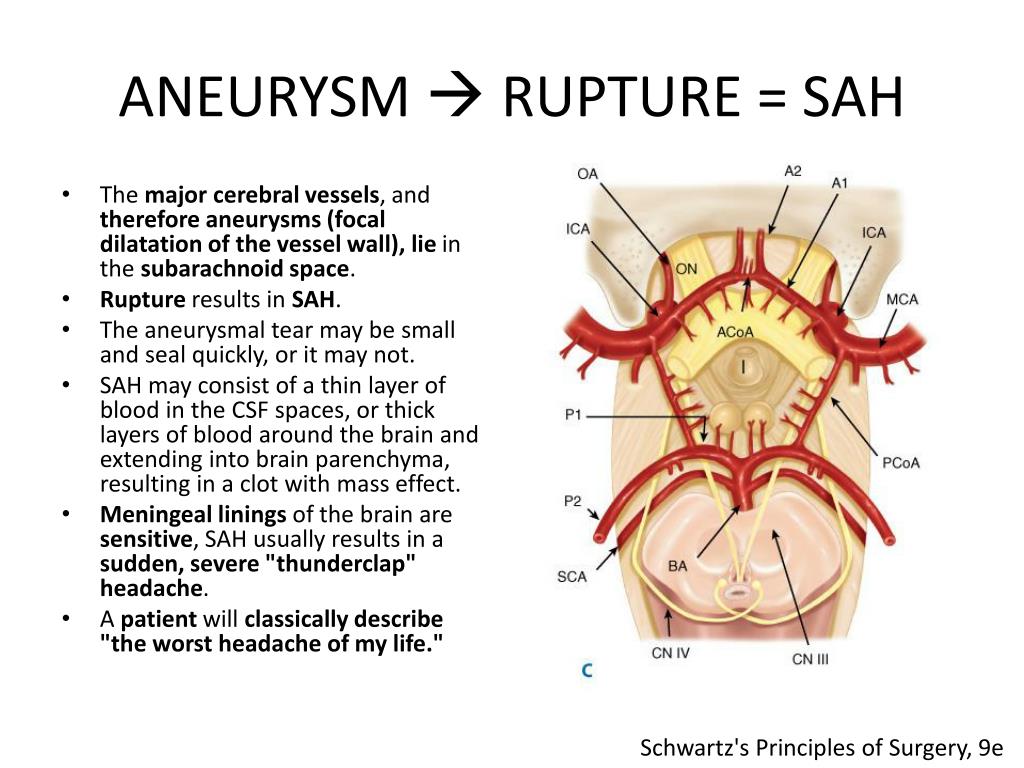 Ppt Neurosurgery Case 3 Subarachnoid Hemorrhage Powerpoint